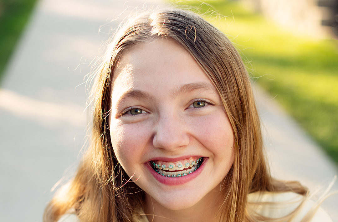 The Different Types of Braces and How to Pick the Best Kind | Hawley ...